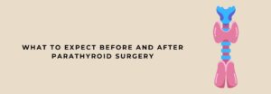 What to Expect Before and After Parathyroid Surgery