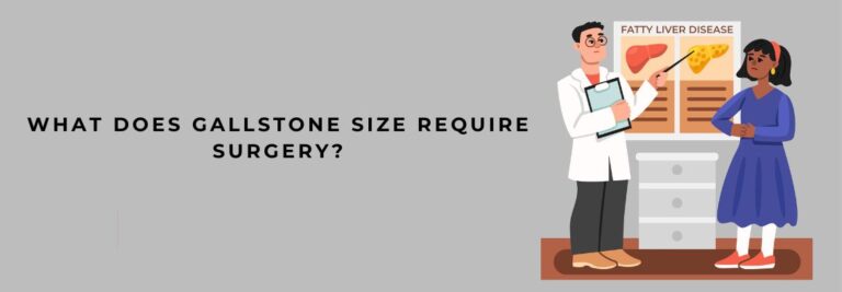What Does Gallstone Size Require Surgery?